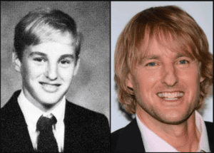 What Happened to Owen Wilson’s Nose, Did He Break It?